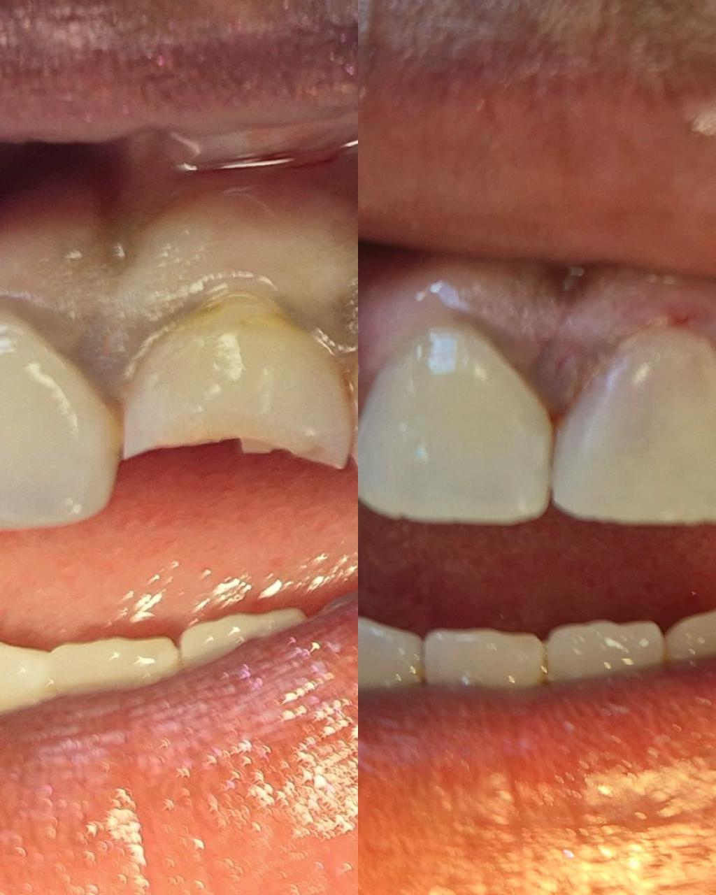 Before and After – Dental Arts Clinic