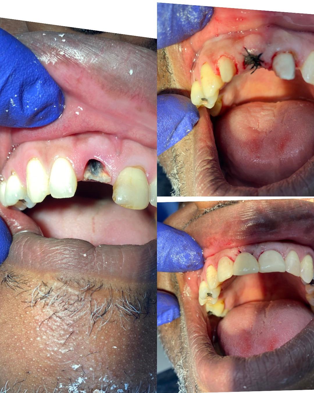 Before and After – Dental Arts Clinic