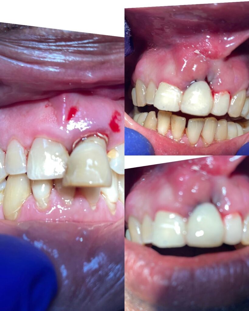 Before and After – Dental Arts Clinic